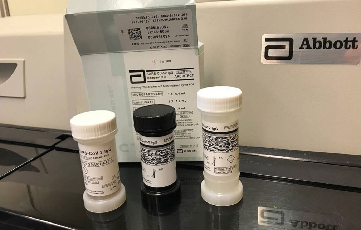 „Best Way Investment“ донира најнови корона тестови за македонското ...